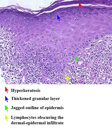 Medicine Decoded: June 2008